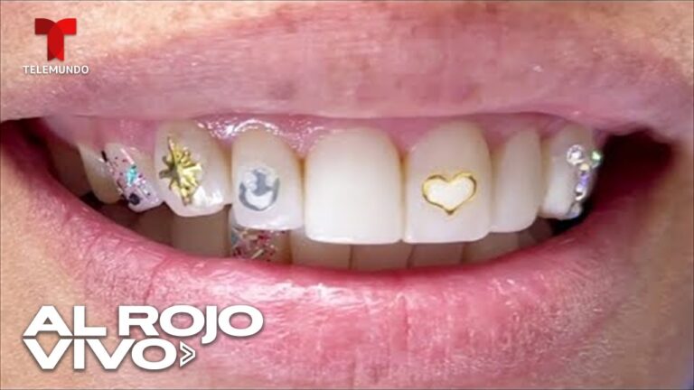 ¡Descubre cómo pegar piedras en los dientes de forma segura y efectiva ...